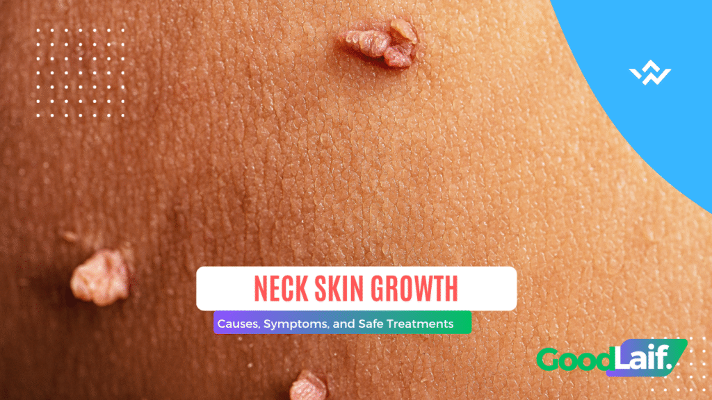 Neck Skin Growth: Causes, Symptoms, and Safe Treatments - Reach Your ...